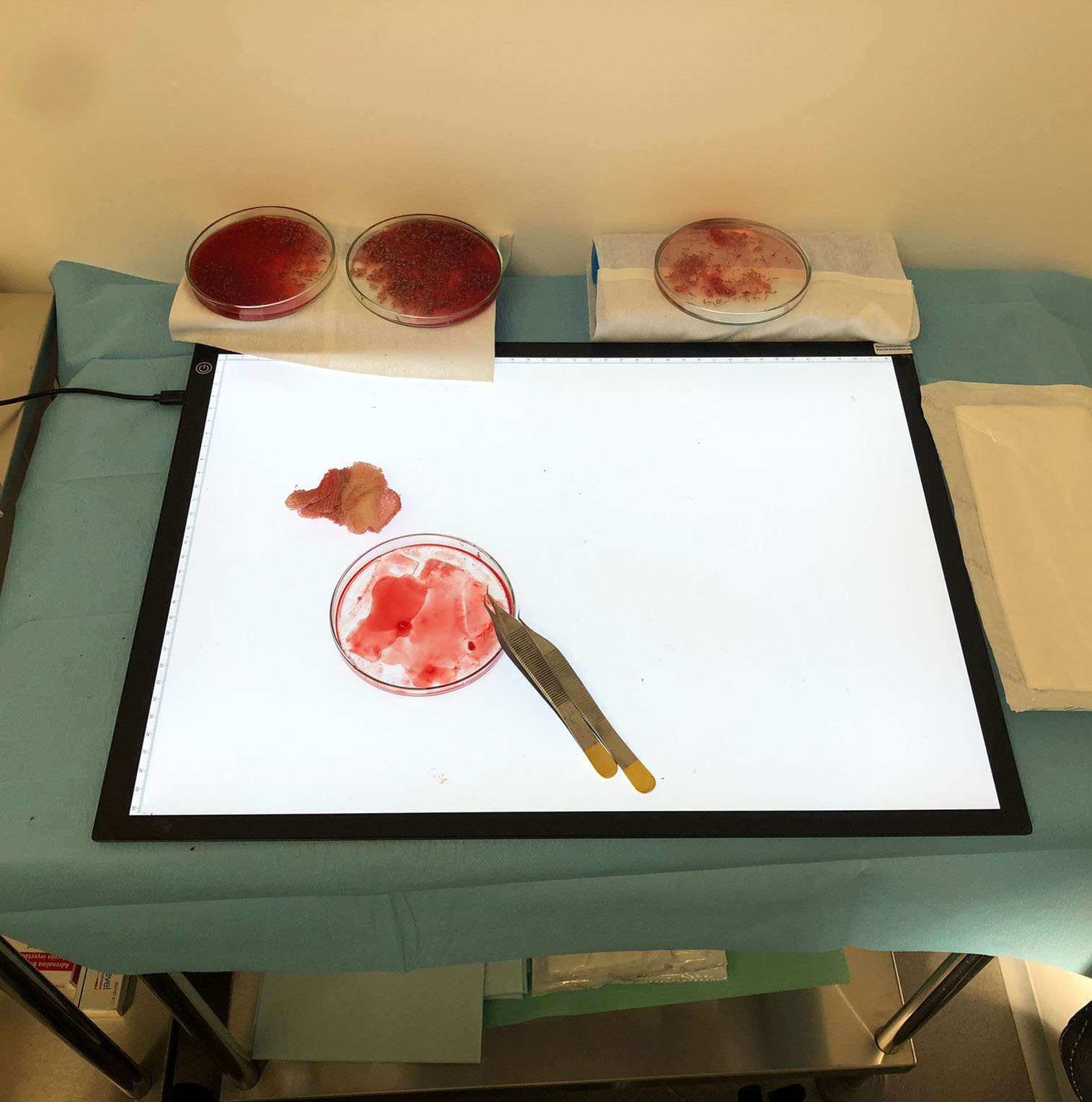 Dermatología y Trasplante Capilar - Derma Clinic Spain